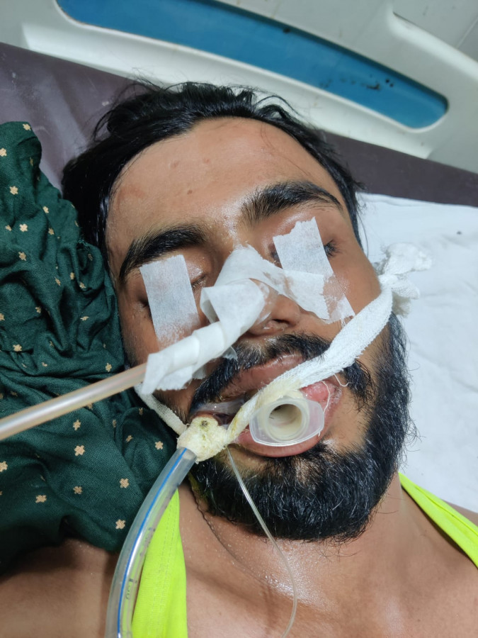 Brain stroke rajesh from Pune