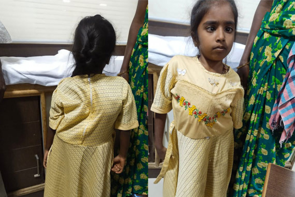 A spinal deformity has caged Shivadarshini's childhood. Support her ...